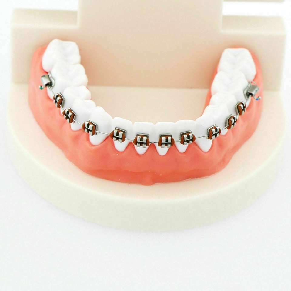 5 Pcs Dental Metal Ceramic Bracket Tube Self-ligating Chain & Teeth ...