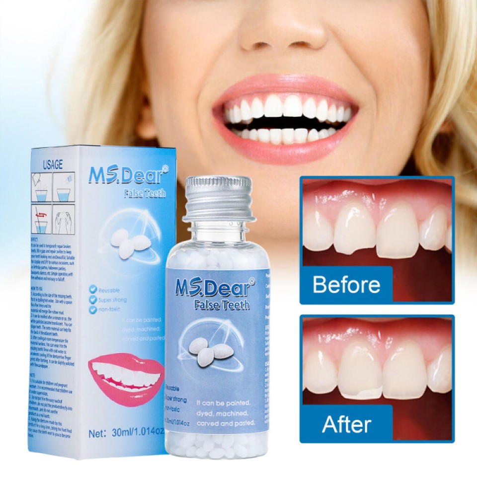 Tooth Repair Granules Temporary Kit Fitting Beads Reusable Moldable ...