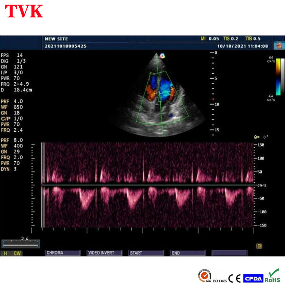 New Mindray 2P2P Phase Sector Array Probe | Grelly USA