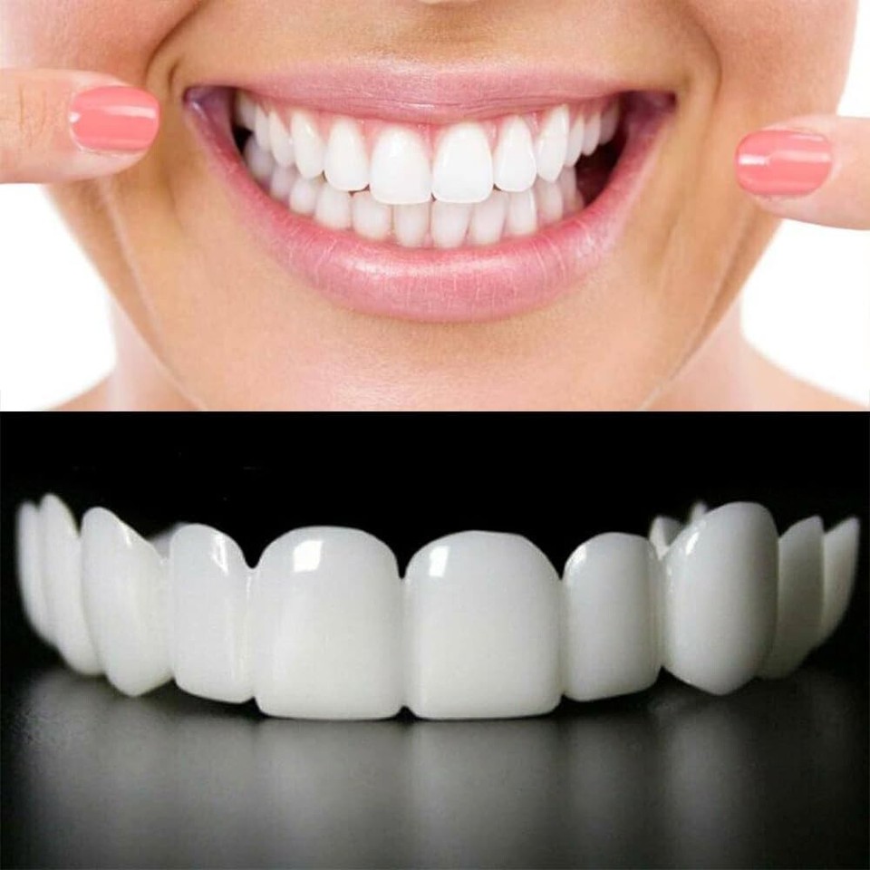Veneers Teeth Snap On Smile Dentures Temporary Teeth 1 Set & Bottom ...