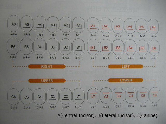 DENTAL PRIMARY ANTERIOR CROWN(stainless steel)(5PCS/box) compatible 3M ...