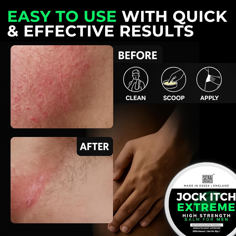 Jock Itch Cream for Men – Antifungal Treatment for Groin, Itching ...