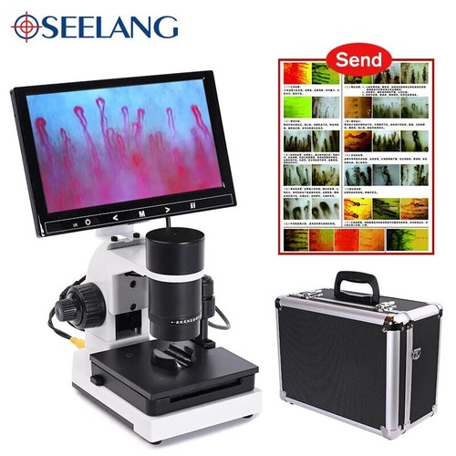Nailfold Capillary Microcirculation HD Digital Microscope Blood ...