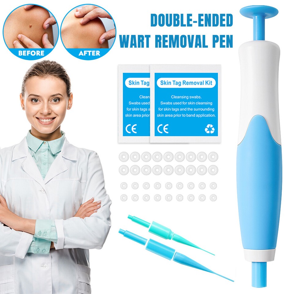 2 in 1 Natural Painless Auto Skin Tag Removal kit Skin tag bands ...