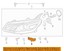 Chevrolet GM OEM 16-18 Malibu-Headlamp Assembly Lower Bracket Right ...