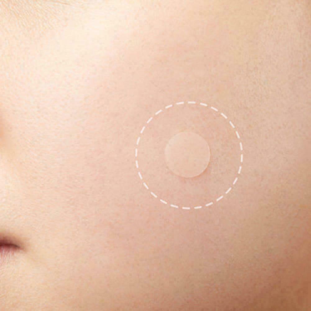 36Pcs Invisible Patches Acne Plasters Pimple Sticker Skin Tags Remover ...