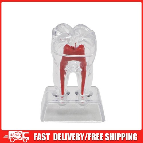 Tooth Molar Model Separable Teaching Demonstration Dental Lab Teeth ...