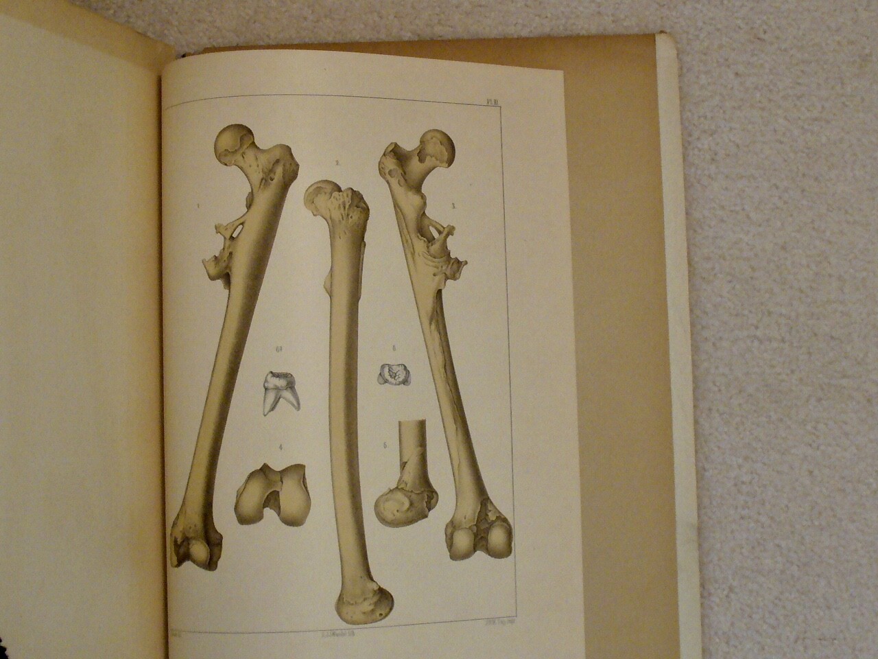 PITHECANTHROPUS ERECTUS by Eugene Dubois 1915 Edition Java Man Homo ...