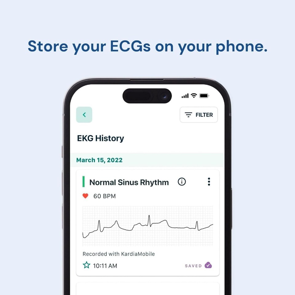 Kardia Mobile EKG Monitor KardiaMobile Personal ECG & Heart Rate ...