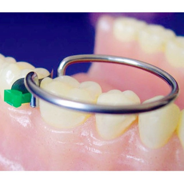 Tor VM 100pcs Dental Matrix Bands Sectional Contoured Matrices Wedges ...