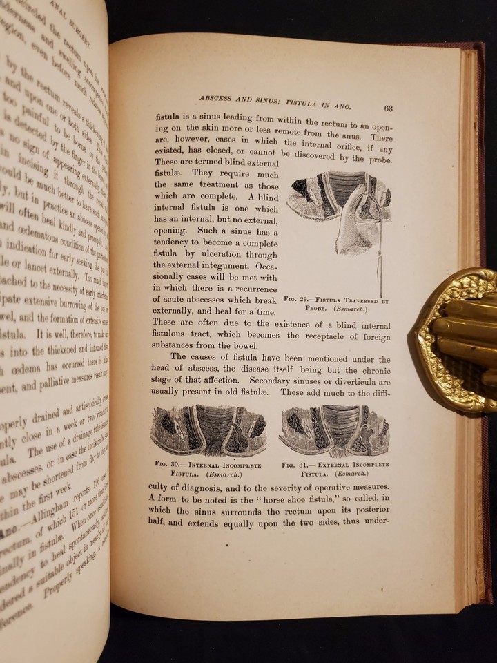 RECTAL SURGERY Secret Methods by by Edmund Andrews 1892 Hardcover ...