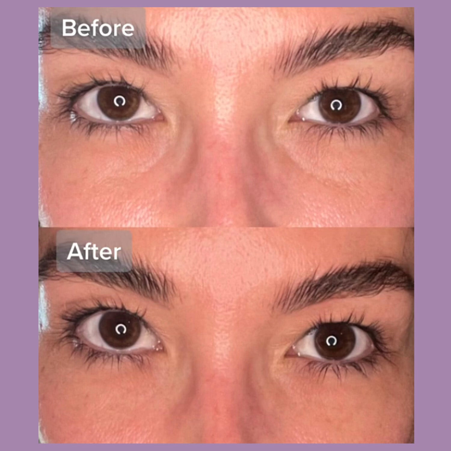 Beverly Hills V-Lift Instant Facelift & Under Eye Tuck 30ml (1 fl oz ...