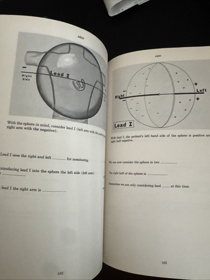 Rapid Interpretation of EKG's by Dale Dubin, M.D. Third Edition ...