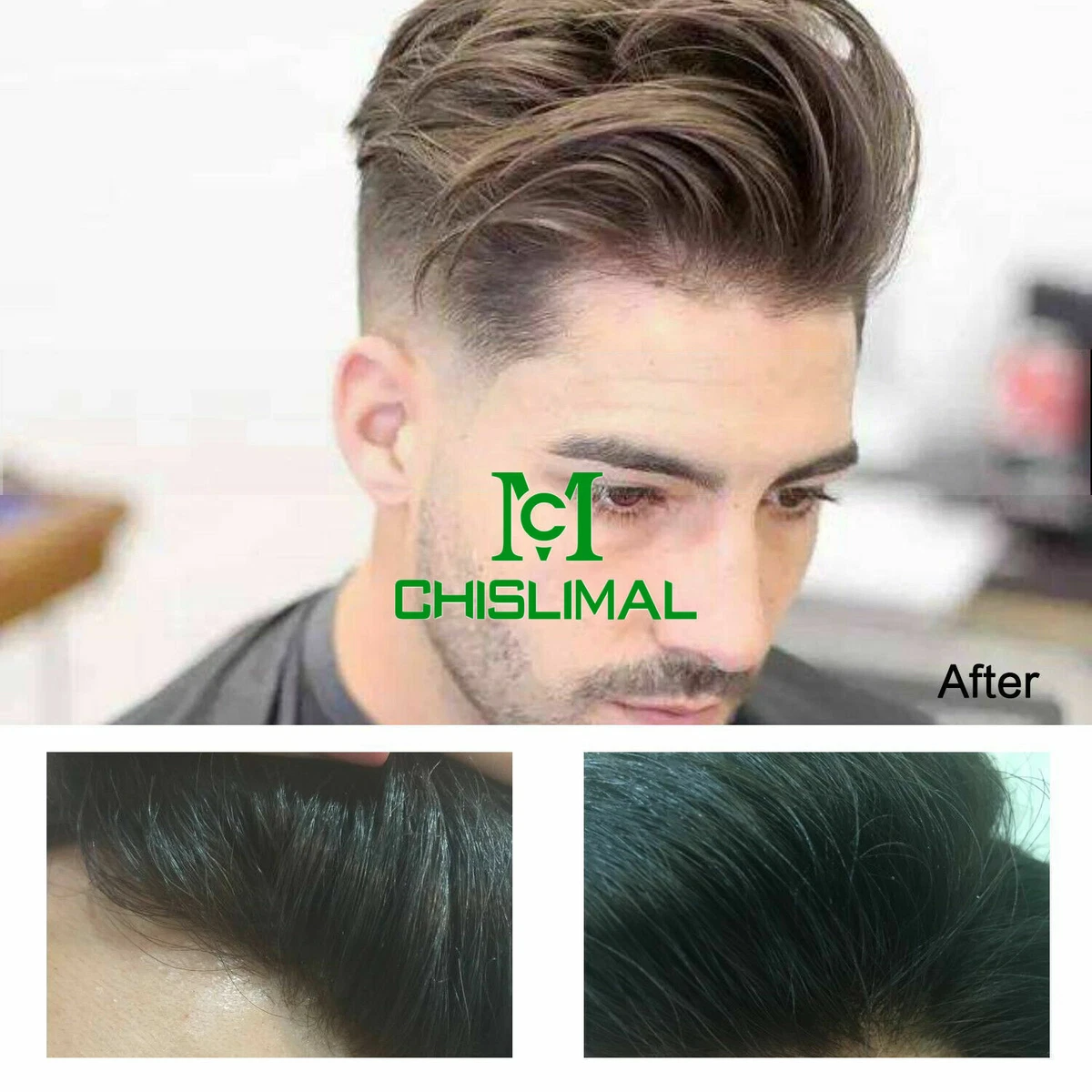 Straight Hairline Men