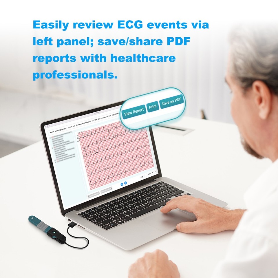 Livenpace Portable Dynamic ECG EKG Holter Recorder 24 Hours PC AI ...