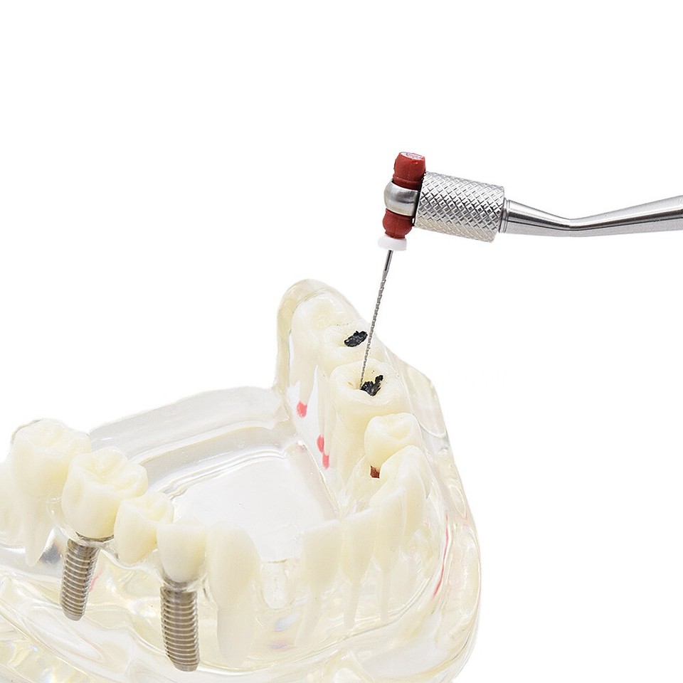 Dental Files Holders K-File Handle Endodontic Posterior Root Canal Clip ...