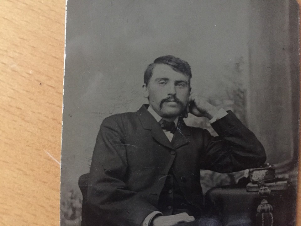 FREAK STRANGE ODDITY SPINAL MEDICAL CONDITION ANOMALY: Man with No Neck ...