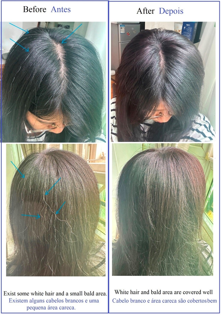 100%Human Hair Free Parting Hair Topper,Super Thin and Breathable,Top ...