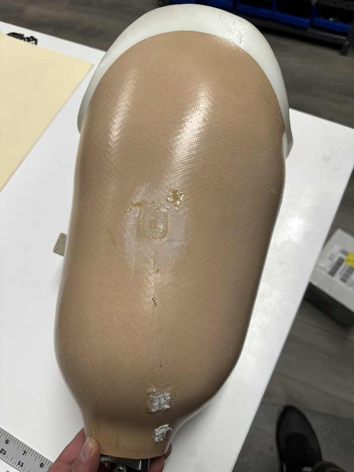 Prosthetic Leg Above Knee Socket - Big | eBay