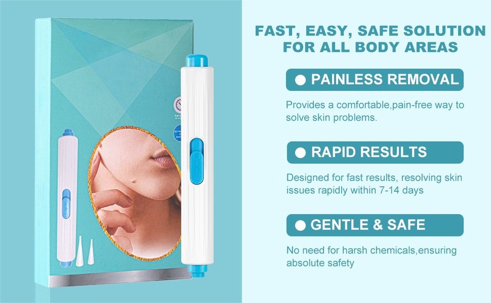 Painless Skin Tag Remover Device Kit Auto Safe Removal 1-9 MM Band Tool ...