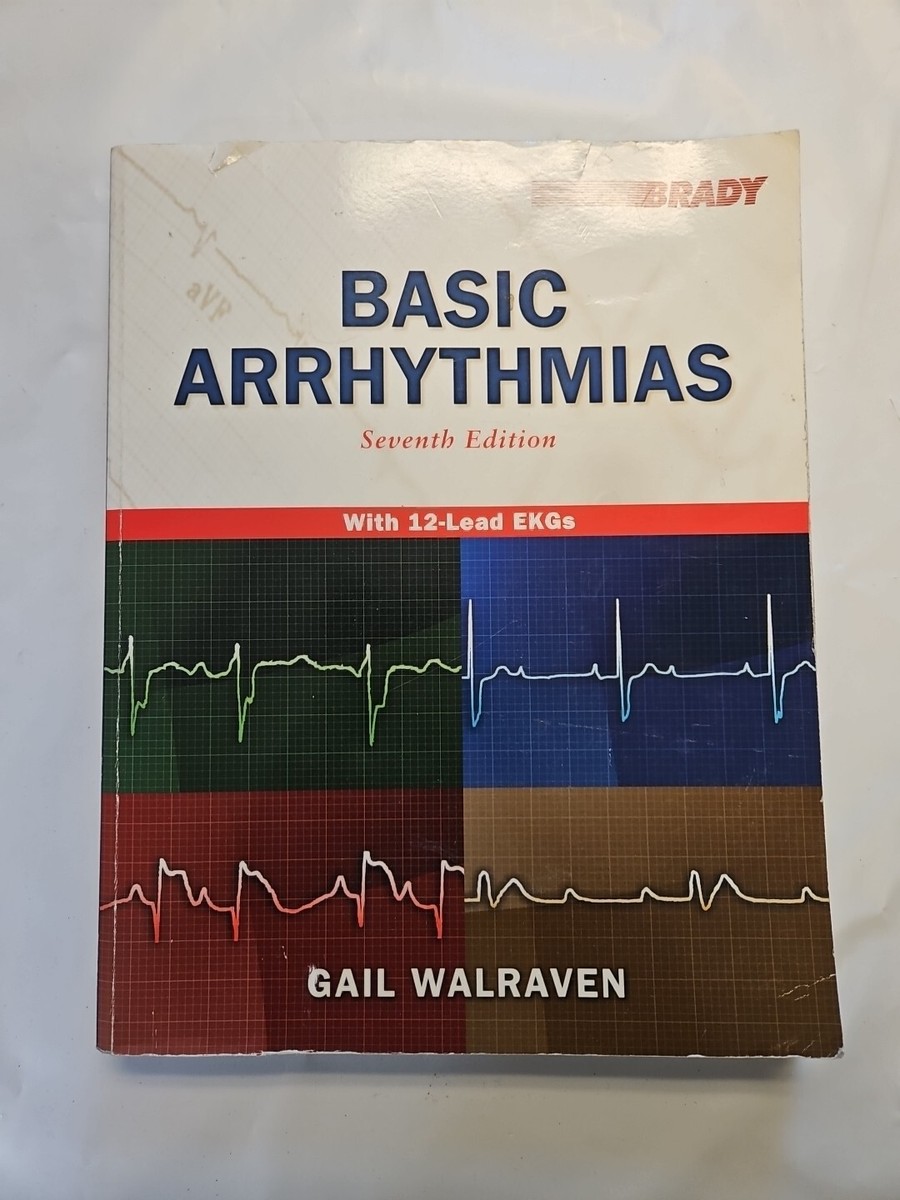 Basic Arrhythmias