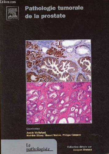 Pathologie tumorale de la prostate - Collection le pathologiste. | eBay