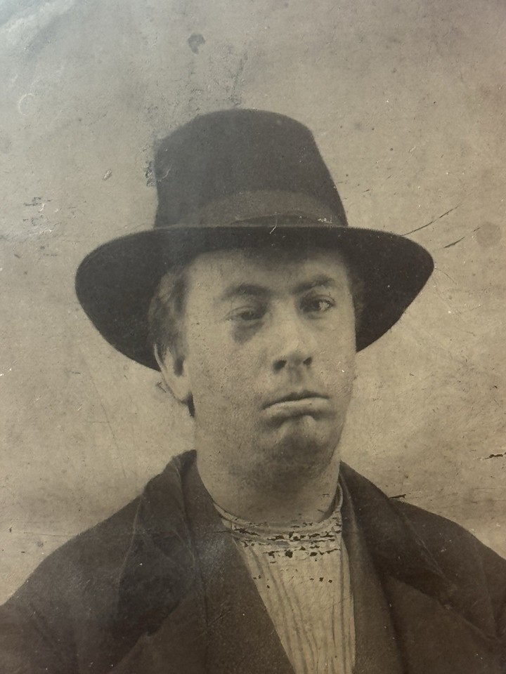 Small Antique Tintype Photo Young Man With Black Eye Or Injured Eye ...