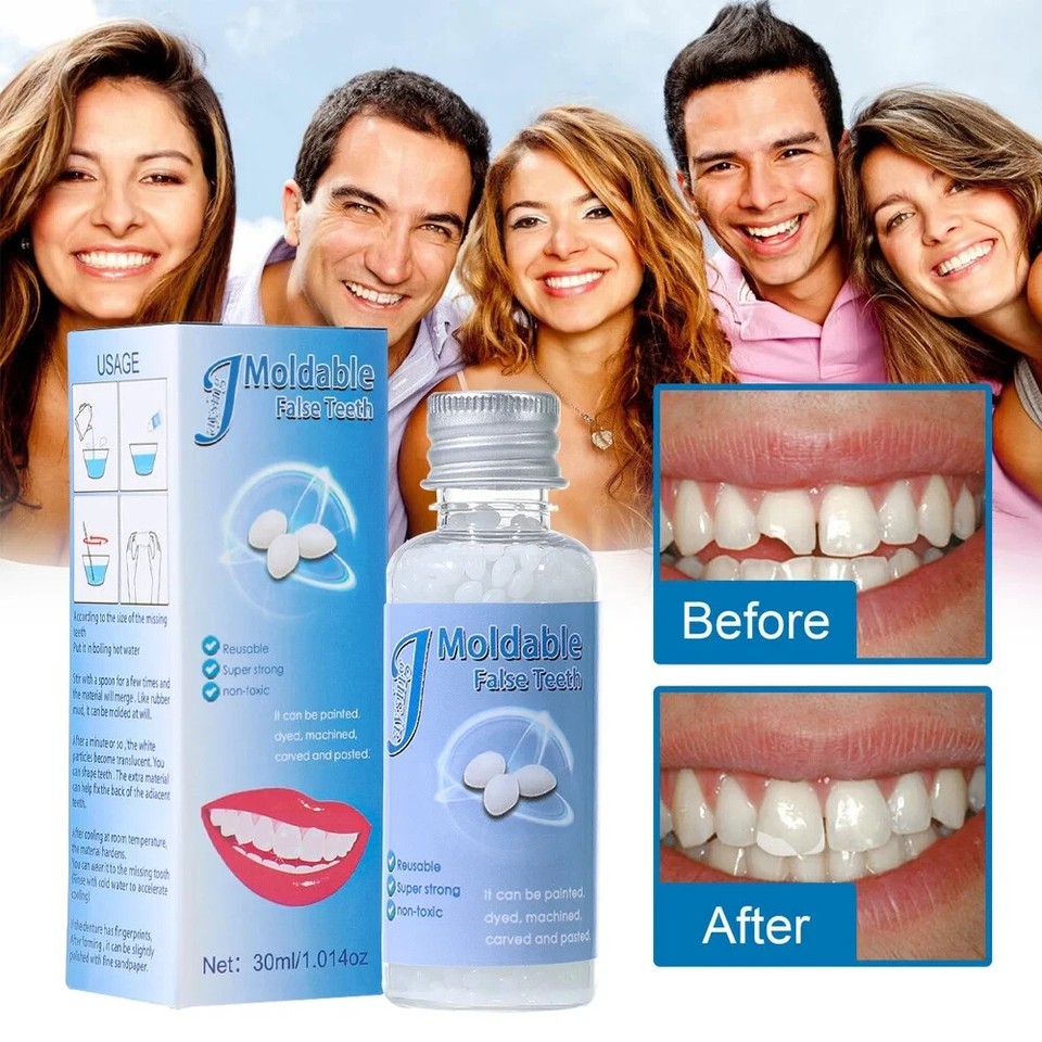 2Pcs Teeth Repair Kit, Temporary False Teeth Moldable False Teeth for ...