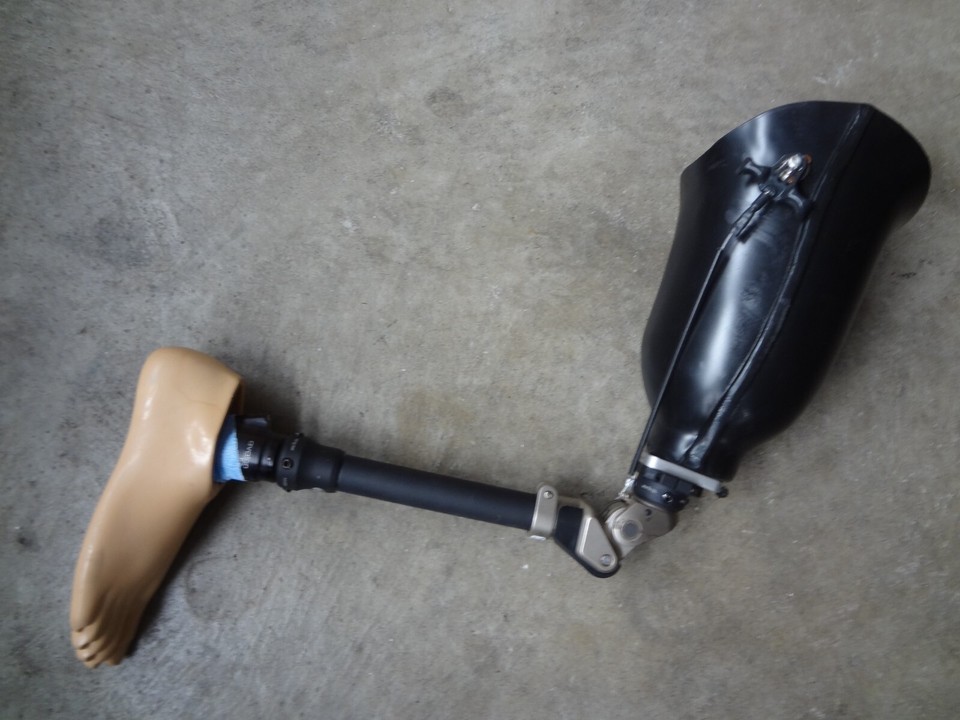 Trulife Right Prosthetic Leg Above The Knee Foot Bend Flex Titanium ...