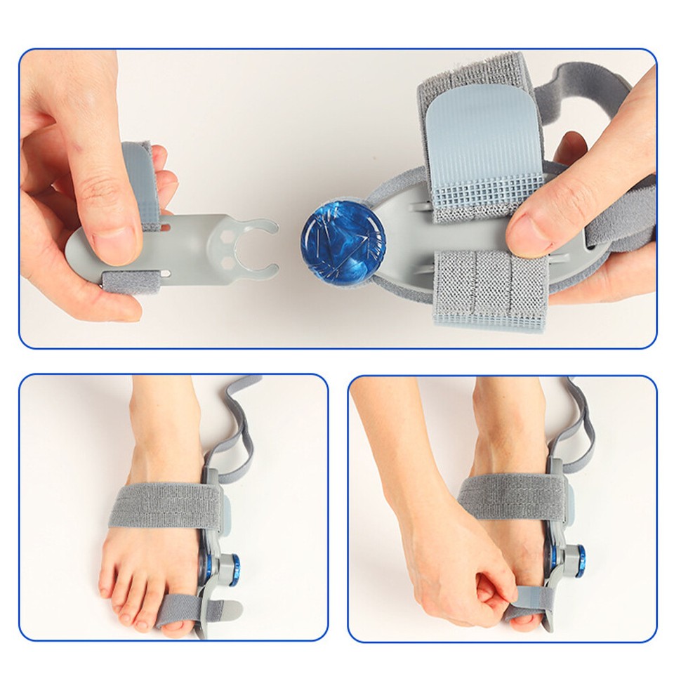 Ergonomics Bunion Fix Toe Valgus Corrector Adjustable Orthosis Women ...
