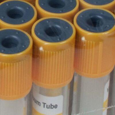 100 Pack 3ml Yellow Gel Blood Collection Tubes - For Medical Lab Use | eBay