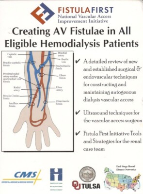 Creating AV Fistulae In All Eligible Hemodialysis Patients AUDIO BOOK ...