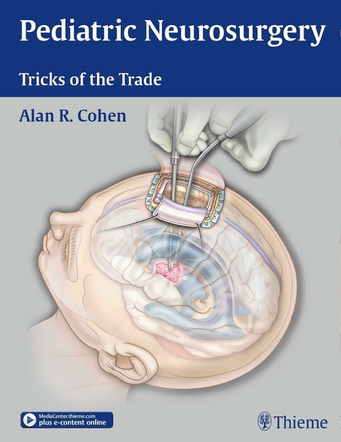 Pediatric Neurosurgery: Tricks of The Trade von Alan R. Cohen (2015 ...