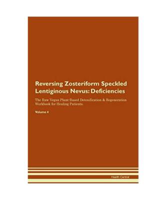 Reversing Zosteriform Speckled Lentiginous Nevus: Deficiencies The Raw ...