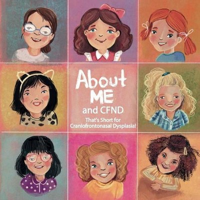 About Me and CFND: That's Short for Craniofrontonasal Dysplasia by ...