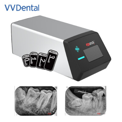 Dental Digital Imaging Phosphor Plate Scanner System HDS-500 PSP ...