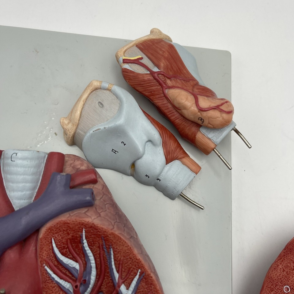 Somso HS7 Lungs with Heart, Diaphragm and Larynx Anatomical Model HS 7 ...