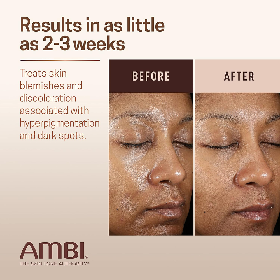 AMBI Skin Dark spot Fade cream Lightening Bleaching Cream Dark Spot ...