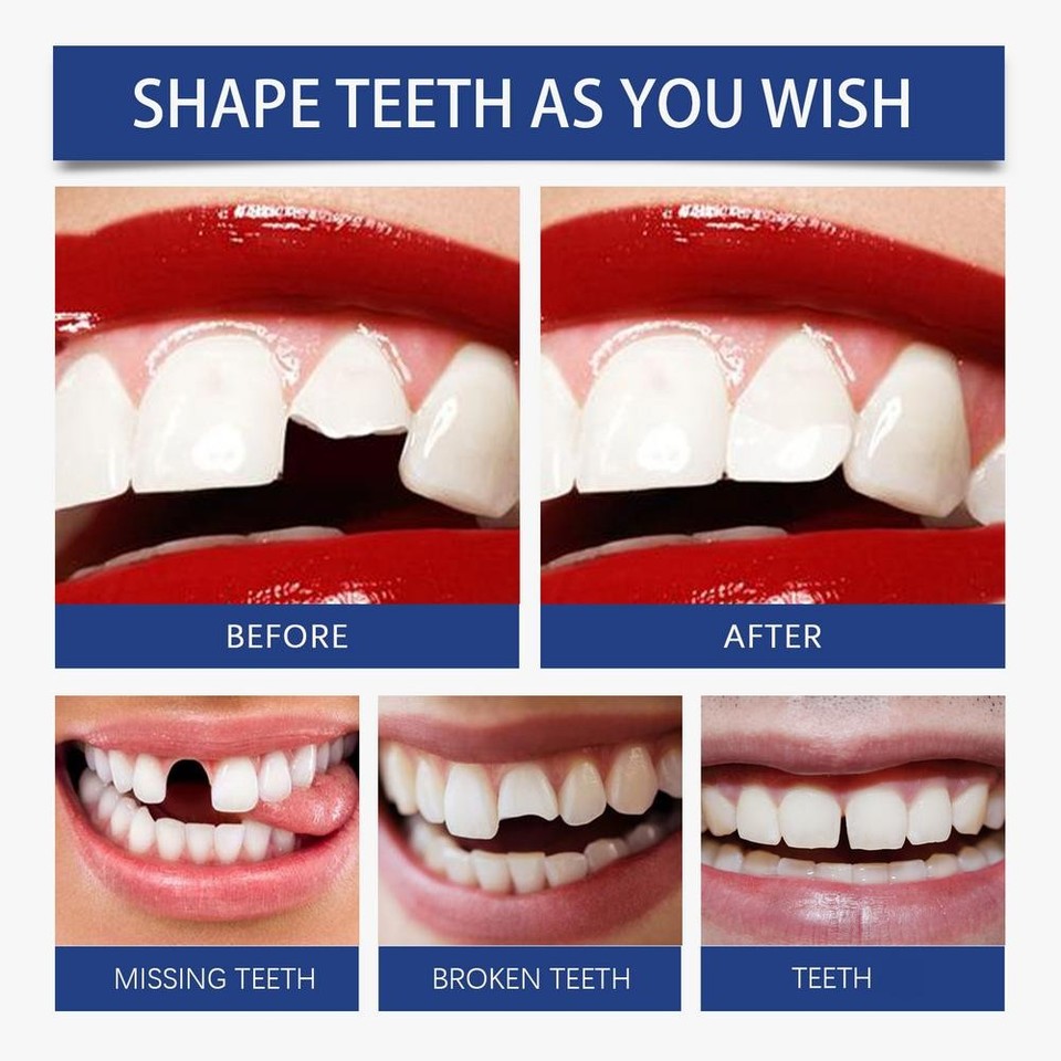 Solid Tooth Gel Temporary Tooth Repair Teeth And Gaps False Teeth 30g ...