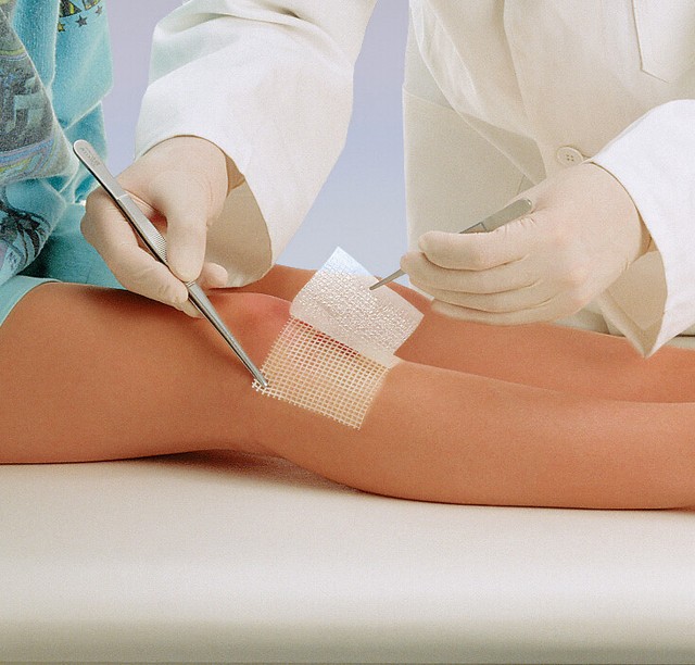 X30 Atrauman Tulle Impregnated Dressings 10 X 20 Cm Wound Aid 499536 ...