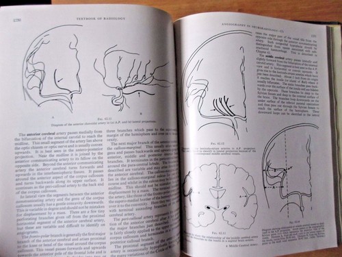 Textbook of Radiology David Sutton HC 1975 | eBay