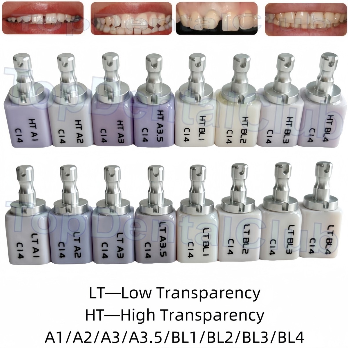 Lithium Disilicate CAD/CAM Blocks 5-Piece Emax C14 Dental Ceramic ...