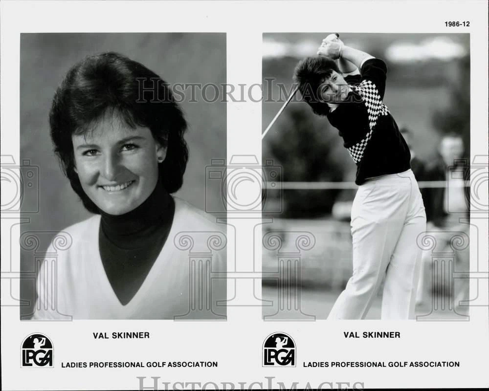 Val Skinner