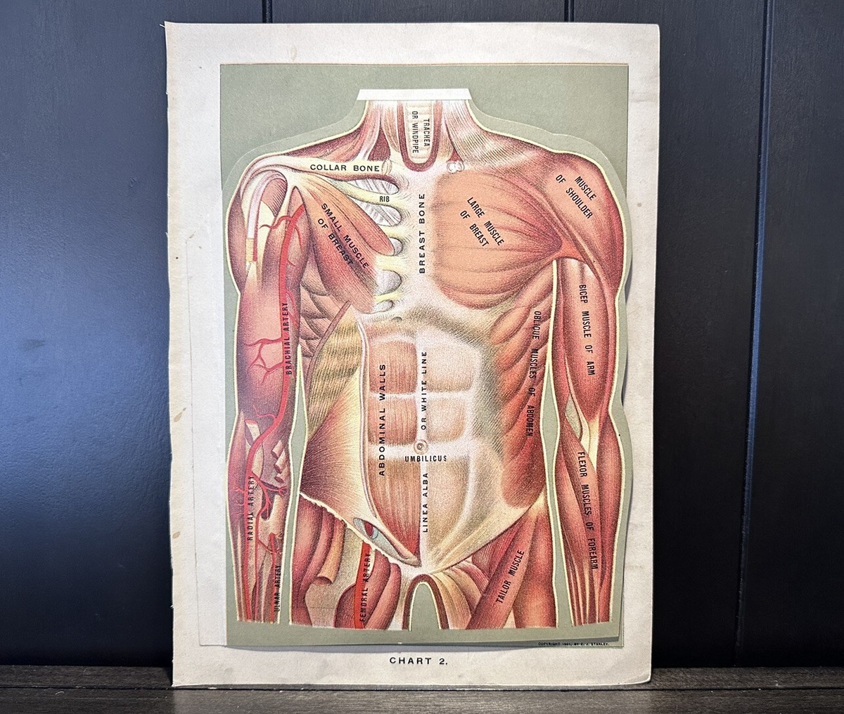 Female Medical Body Chart