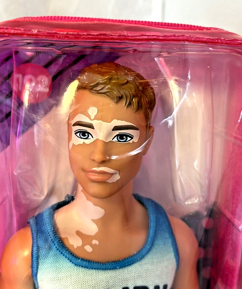 Mattel Barbie Fashionista #192 Malibu Ken Doll Vitiligo Skin Condition ...