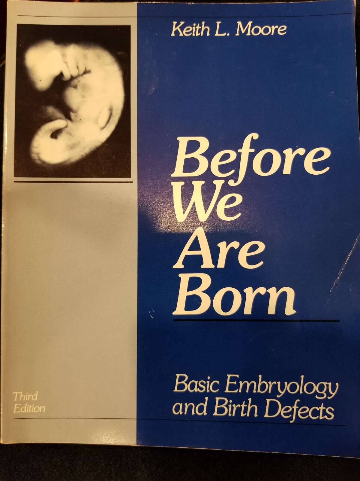 Before We Are Born : Basic Embryology and Birth Defects by Keith L ...