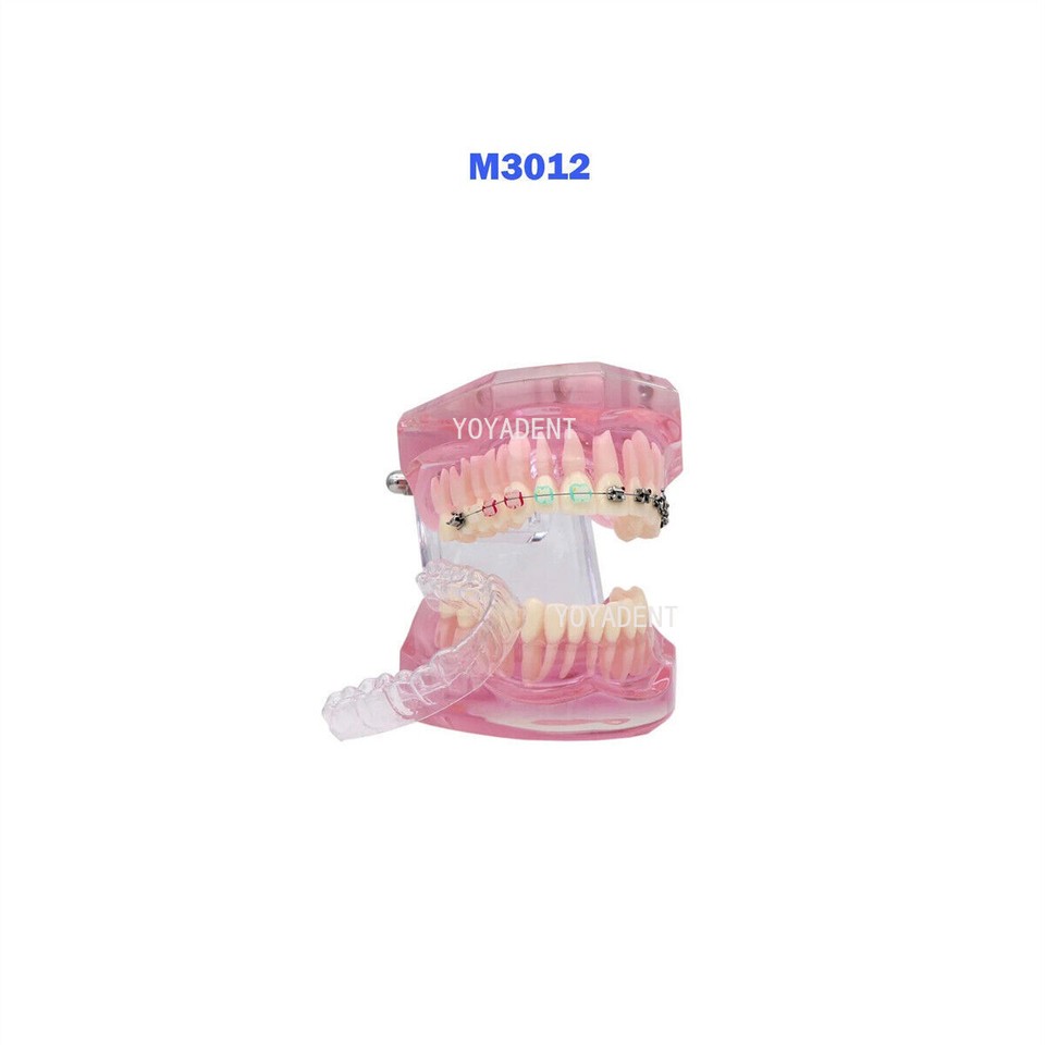 Teeth Model Dental Typodont Ortho Implant Pathological Perio Practice ...
