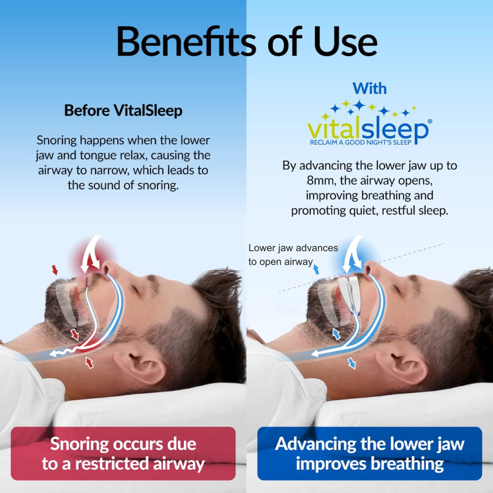 VitalSleep Anti Snoring Mouthpiece Adjustable Snoring Mouth Guard USA ...
