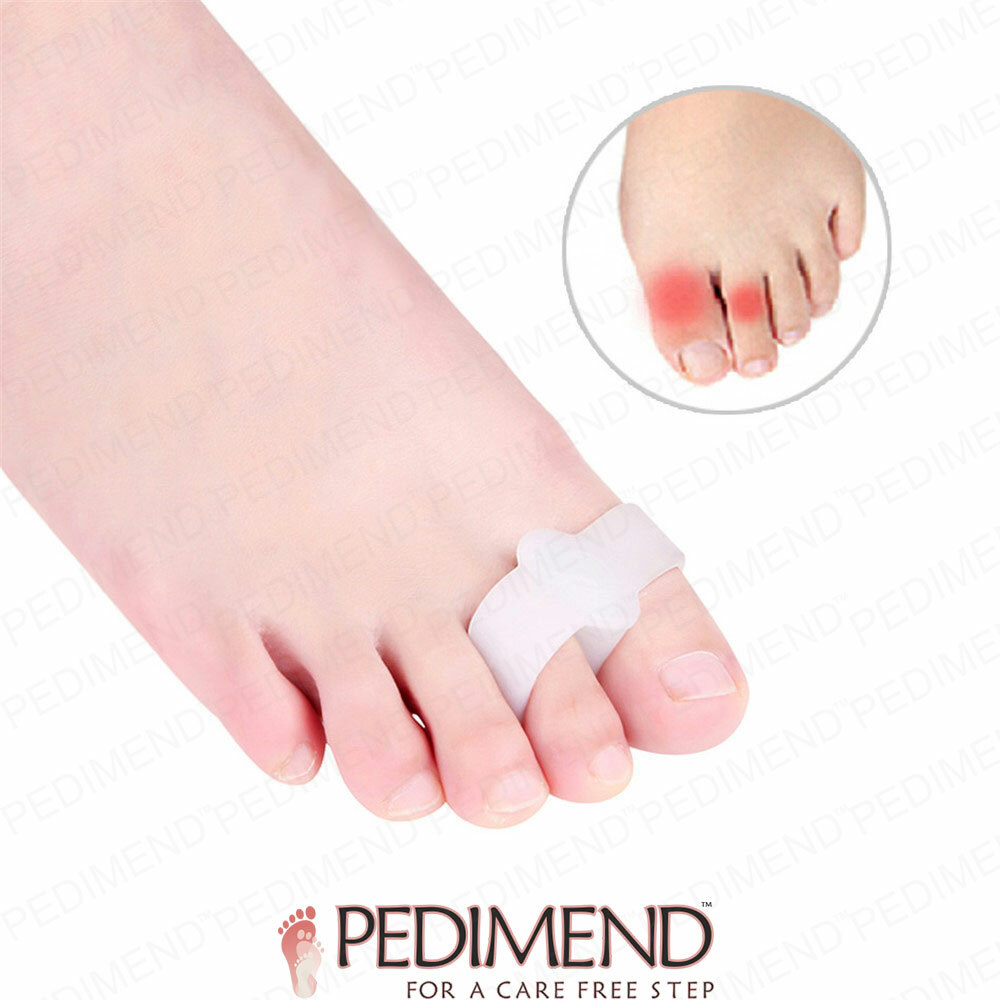 Pedimend Silicone Gel toe straightener toe separators toe stretchers ...
