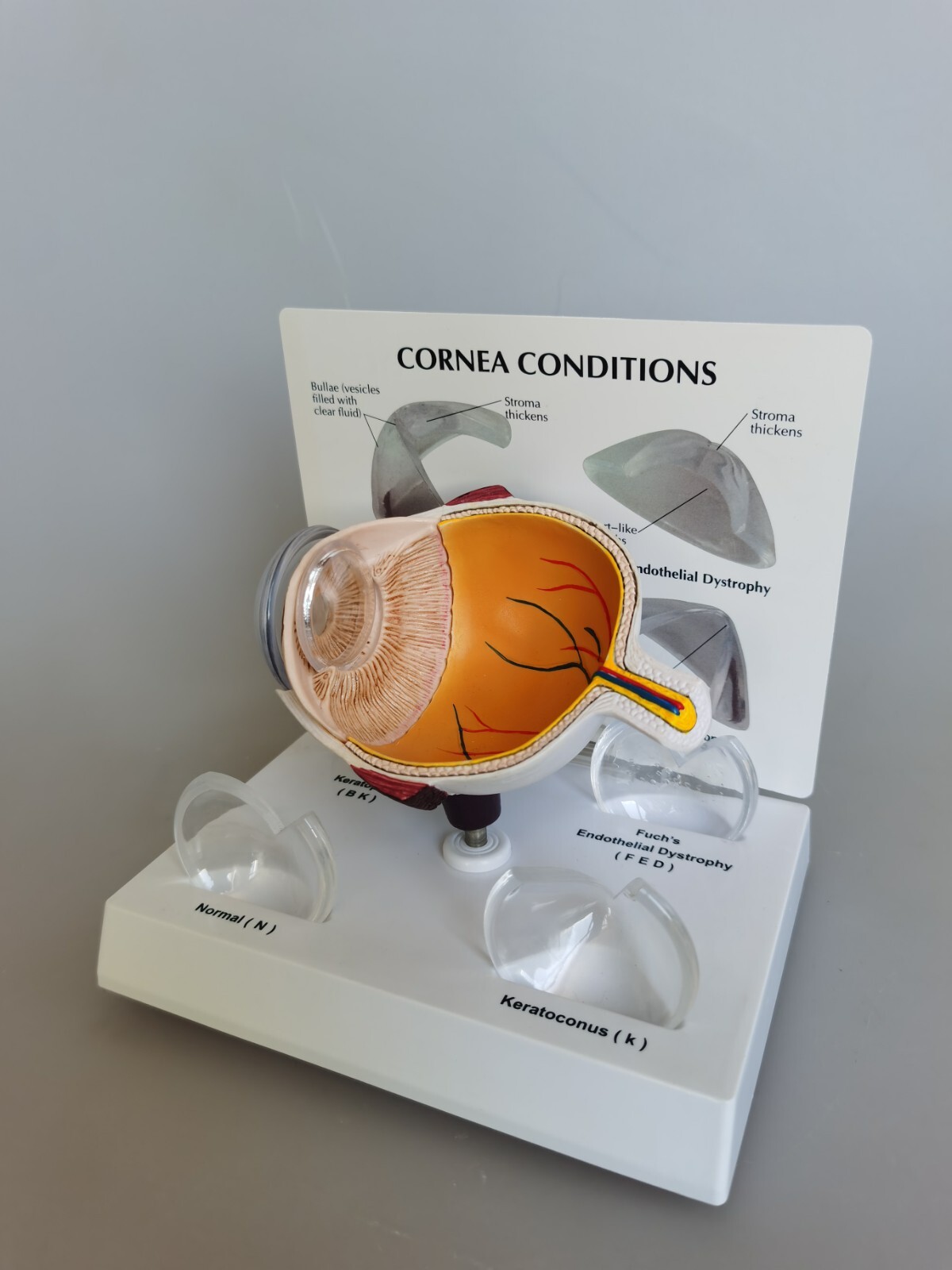 CORNEA CONDITIONS Eye keratopathy eyeball Medical Teaching Anatomical ...